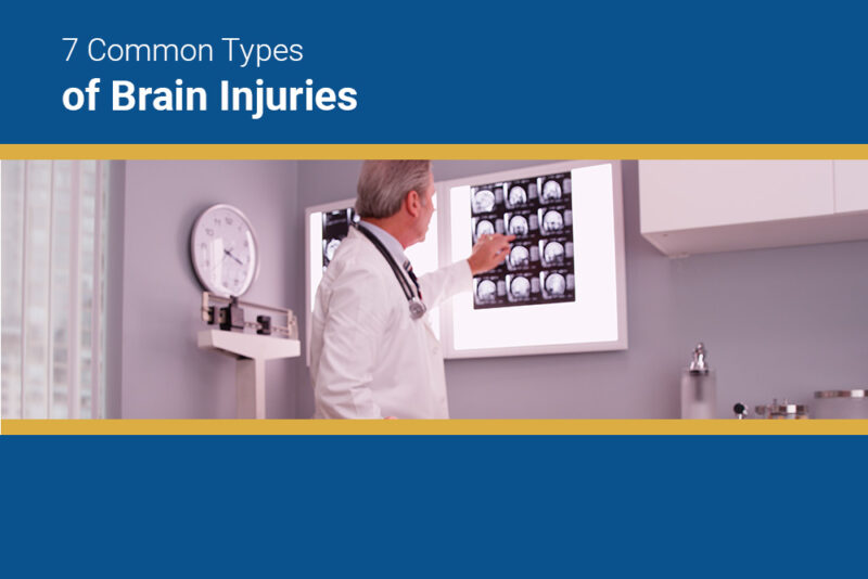 7 Common Types of Brain Injuries